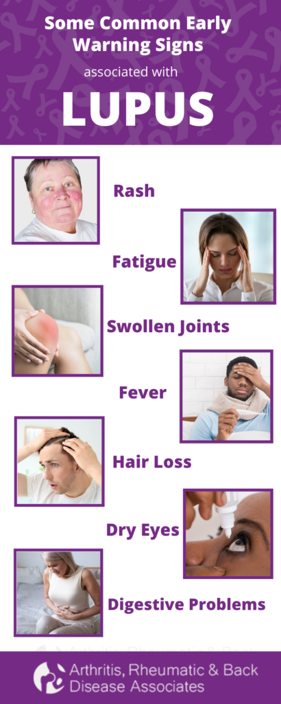 Tips for Living With Lupus and How ARBDA Can Help